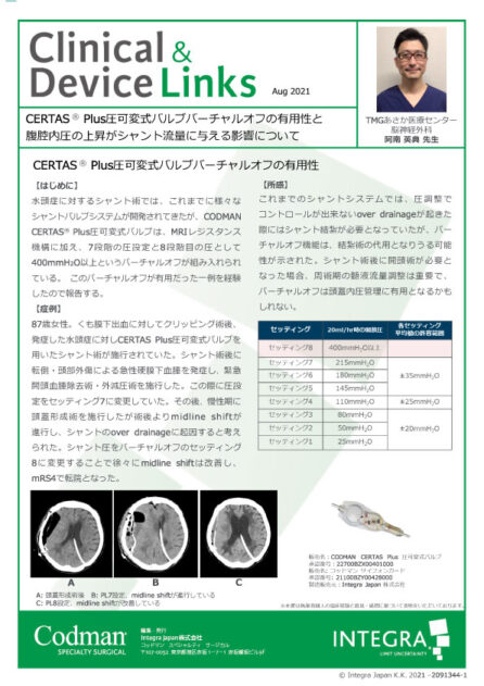 CODMAN® CERTAS® Plus 圧可変式バルブ | INTEGRA ONLINE