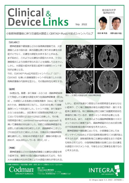 CODMAN® CERTAS® Plus 圧可変式バルブ | INTEGRA ONLINE