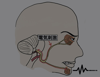 “確実で安全なMVD”のための7つの“肝心”③ | INTEGRA ONLINE